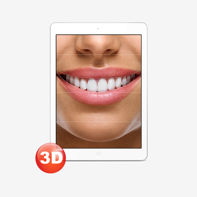 Digital Smile Design 3D